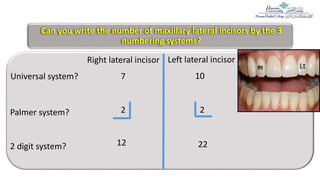 4= Permanent ‏Maxillary lateral incisor.pptx