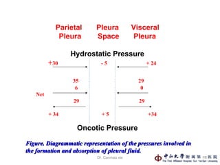 4 pleural effusions | PPT