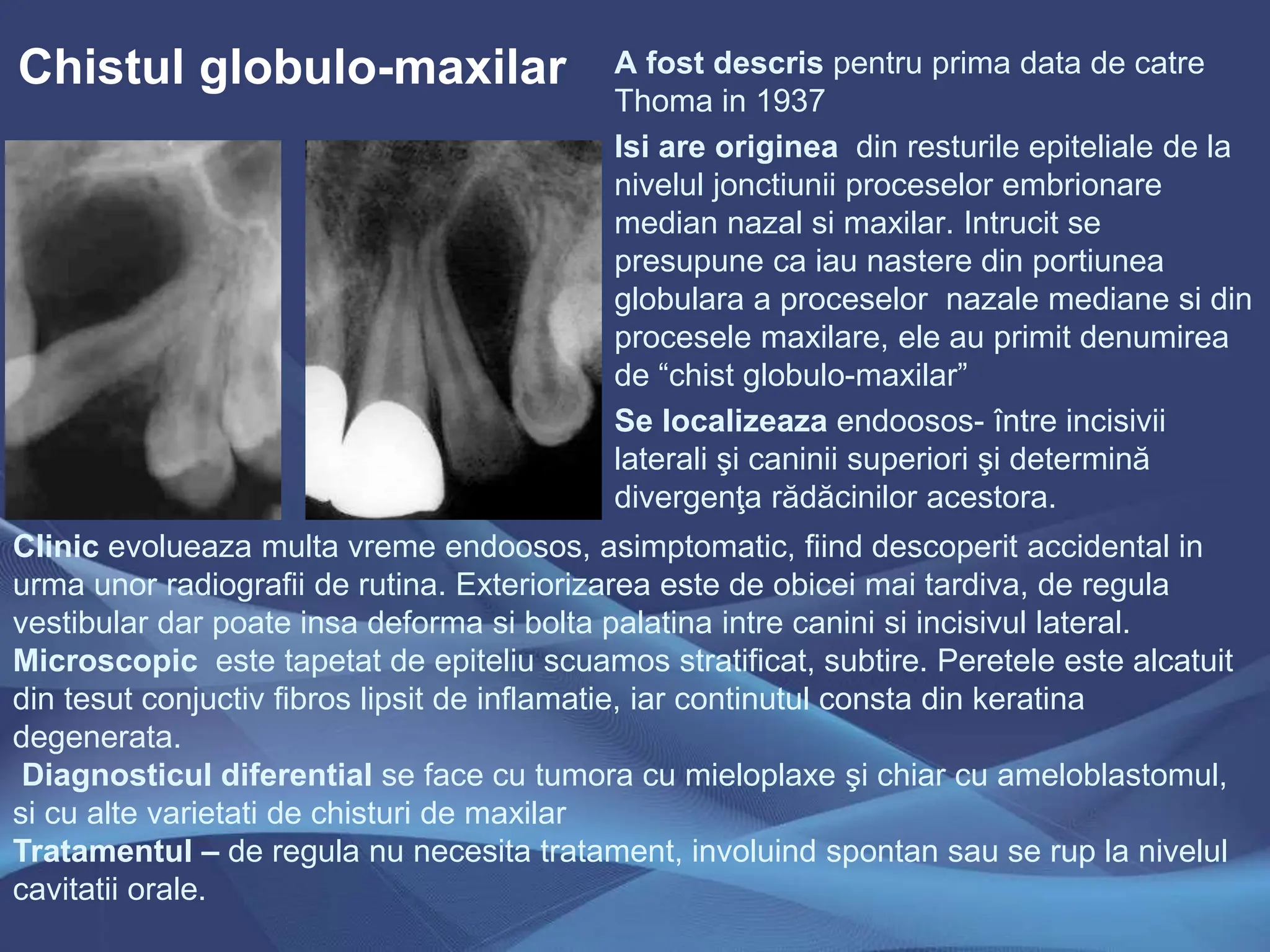 4 Prelegere Chisturile Neodontogene si Pseudochisturile de maxilar.ppt