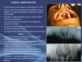 4 Prelegere Chisturile Neodontogene si Pseudochisturile de maxilar.ppt