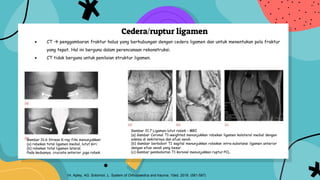Presentasi Knee Disorders.pptx