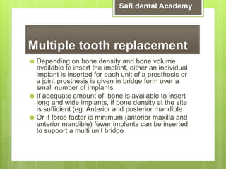 [4]prosthetic options on implants [ 4 ].pptx