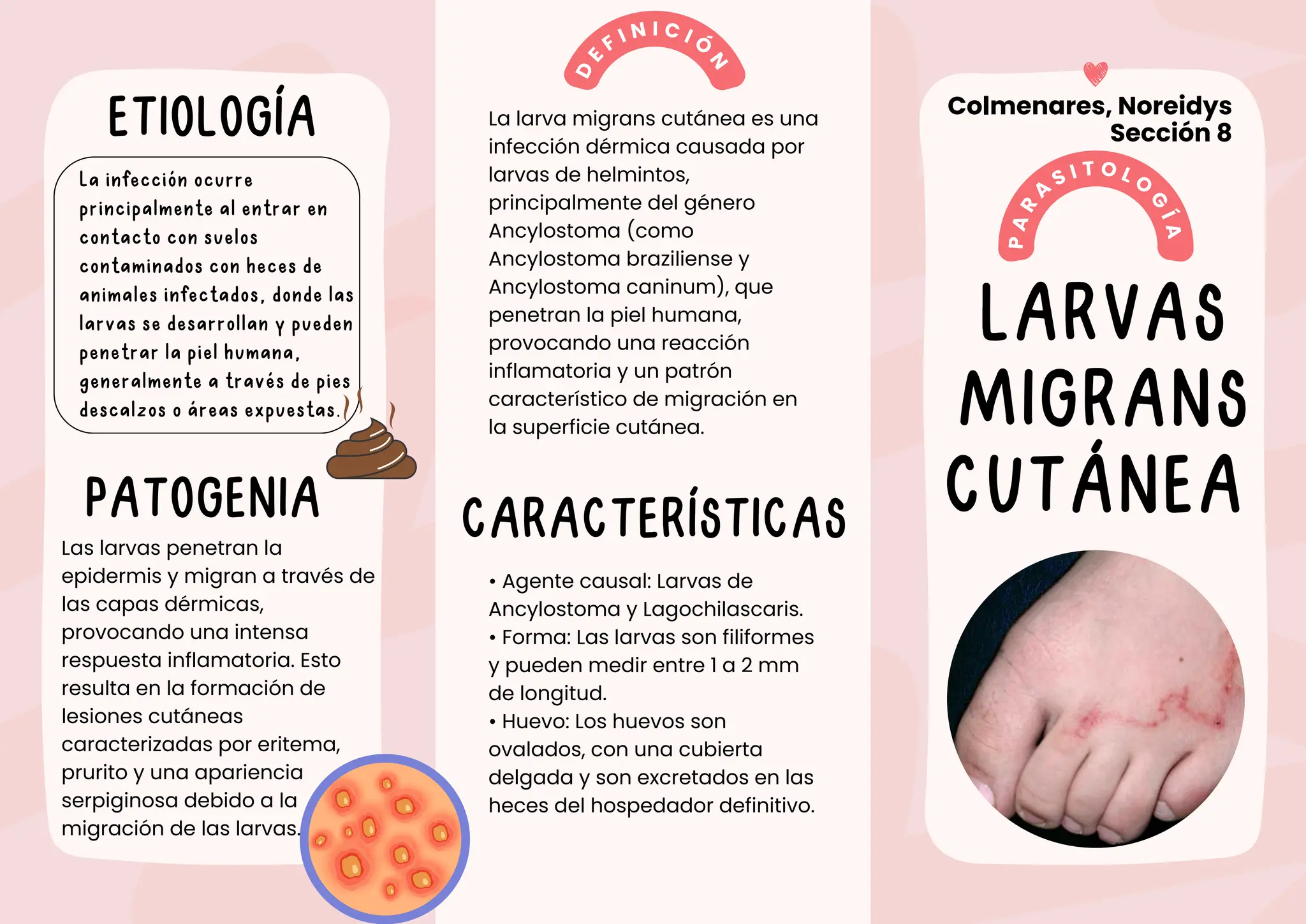 Larvas_migrans_cutanea, presentación medicina. | PPT