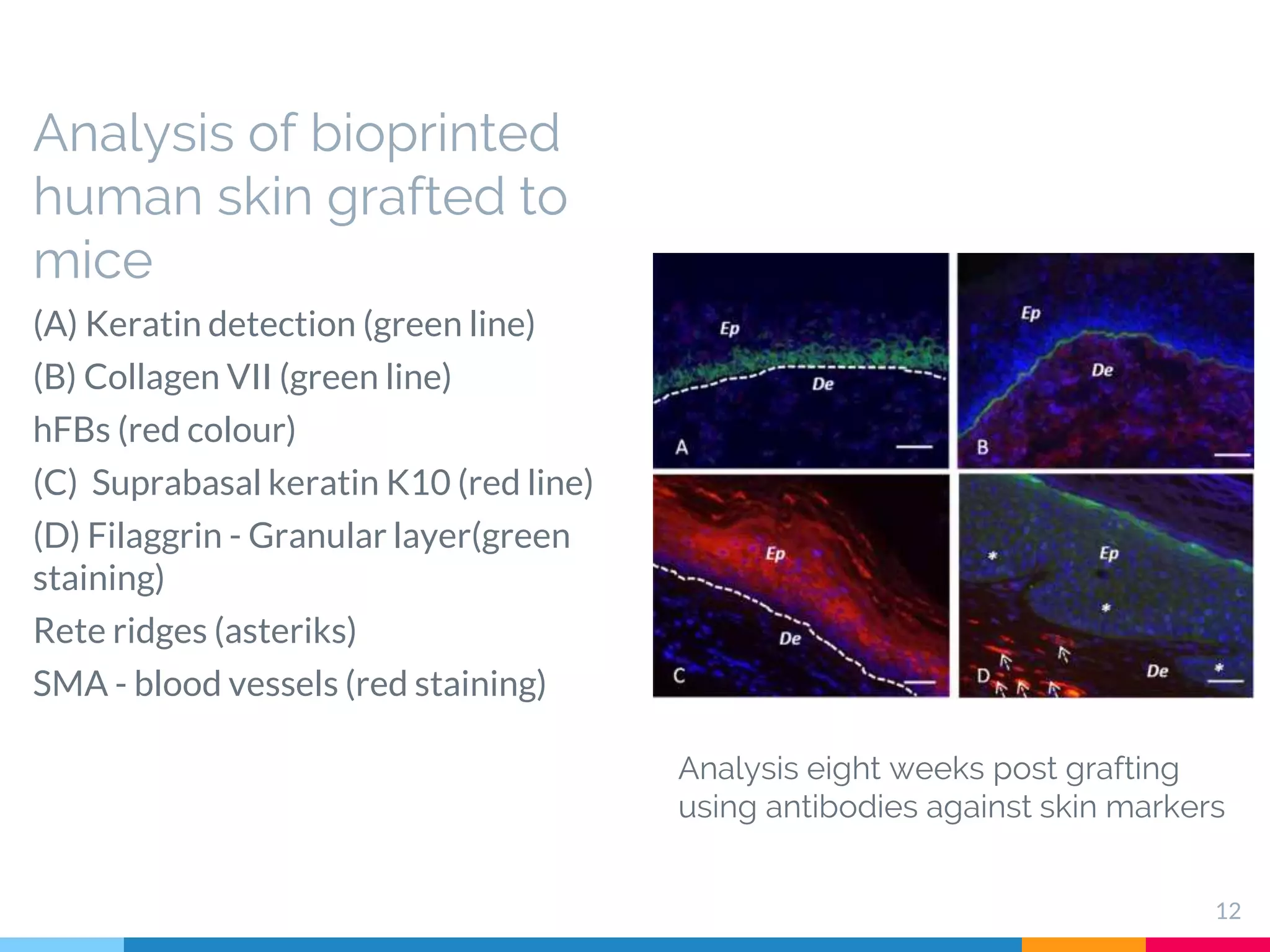 3D Bioprinting of human skin | PPTX