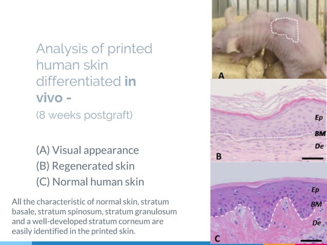 3D Bioprinting of human skin | PPTX
