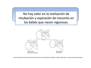 4 reanimación neonatal | PPTX