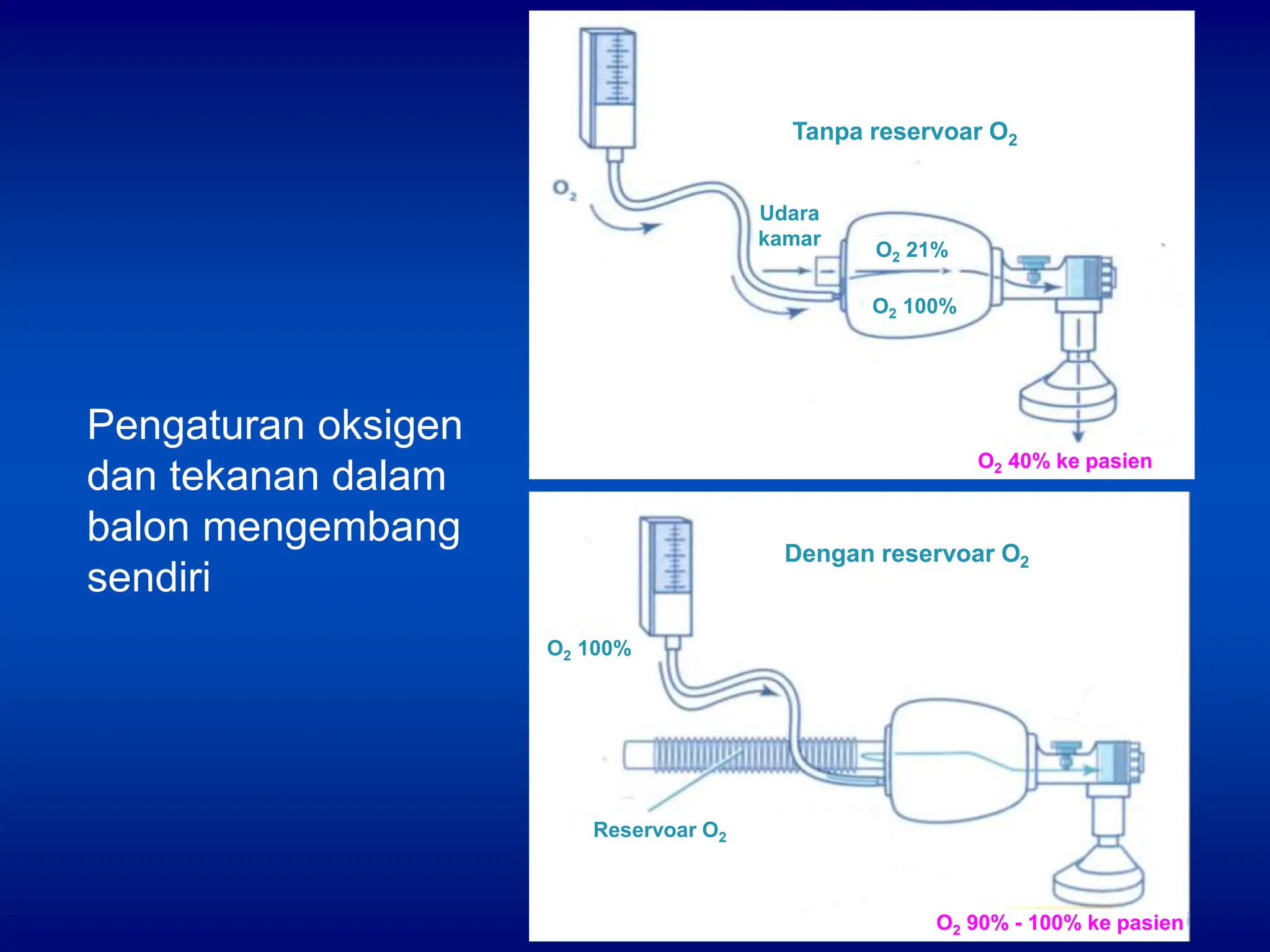 Resusitasi neonatus update | PPT
