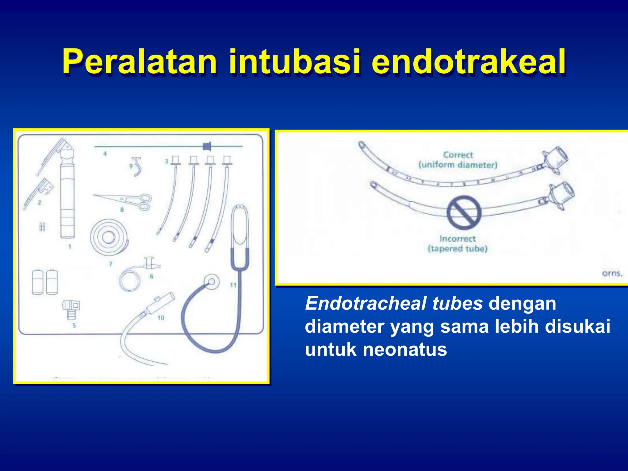Resusitasi neonatus update | PPT