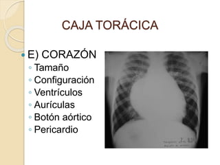 Rayos X de Torax P.A. | PPTX