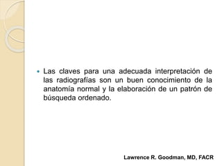 Rayos X de Torax P.A. | PPTX