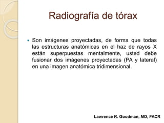 Rayos X de Torax P.A. | PPTX