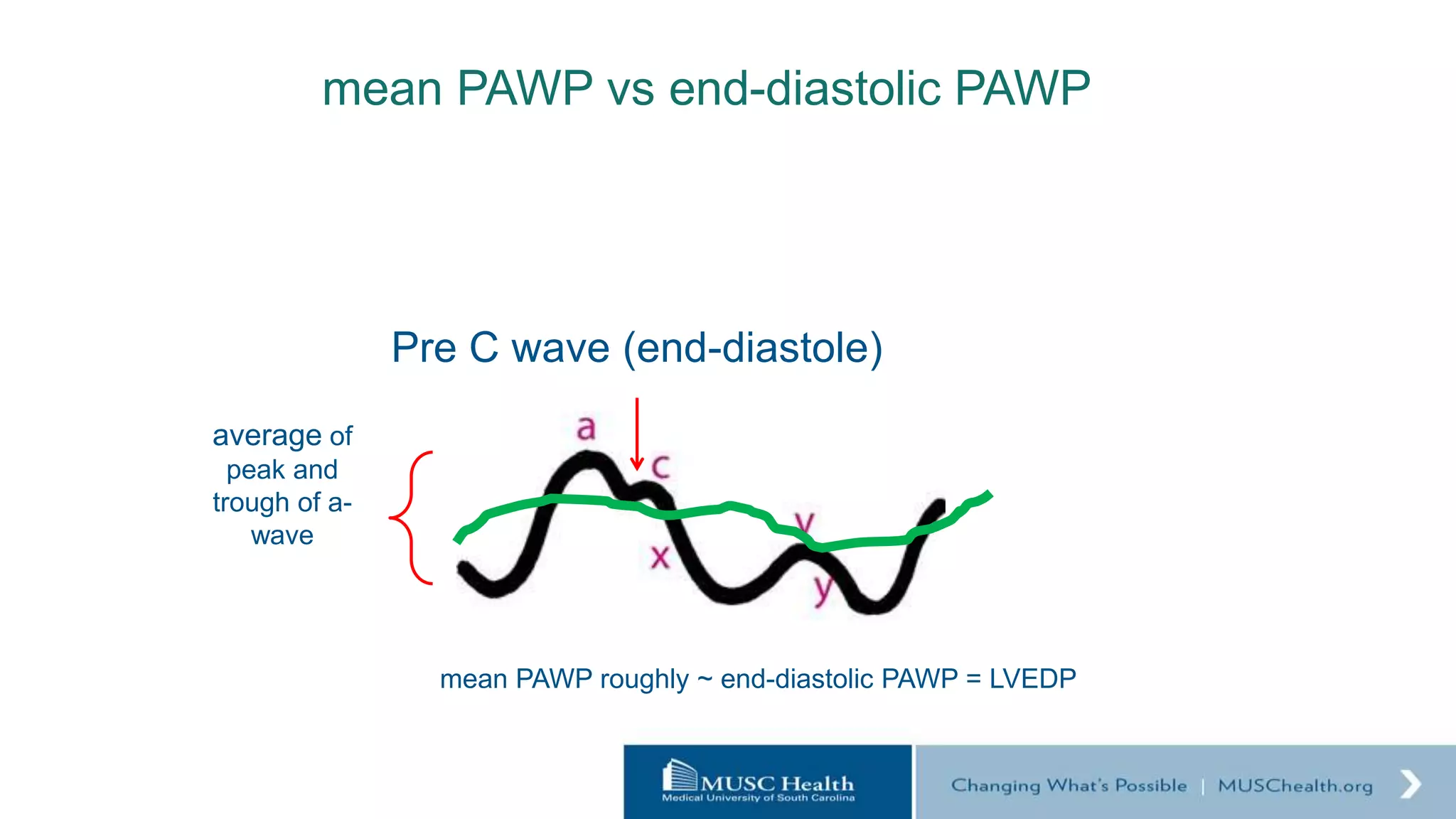 Hemodynamic Evaluation of Pulmonary Hypertension: Principles and Best ...