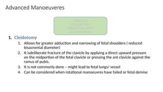shoulder dystocia in obstetrics edit.pptx