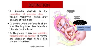 shoulder dystocia in obstetrics edit.pptx