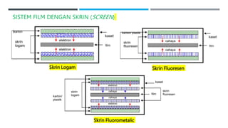Sistem Film Radiografi.pptx