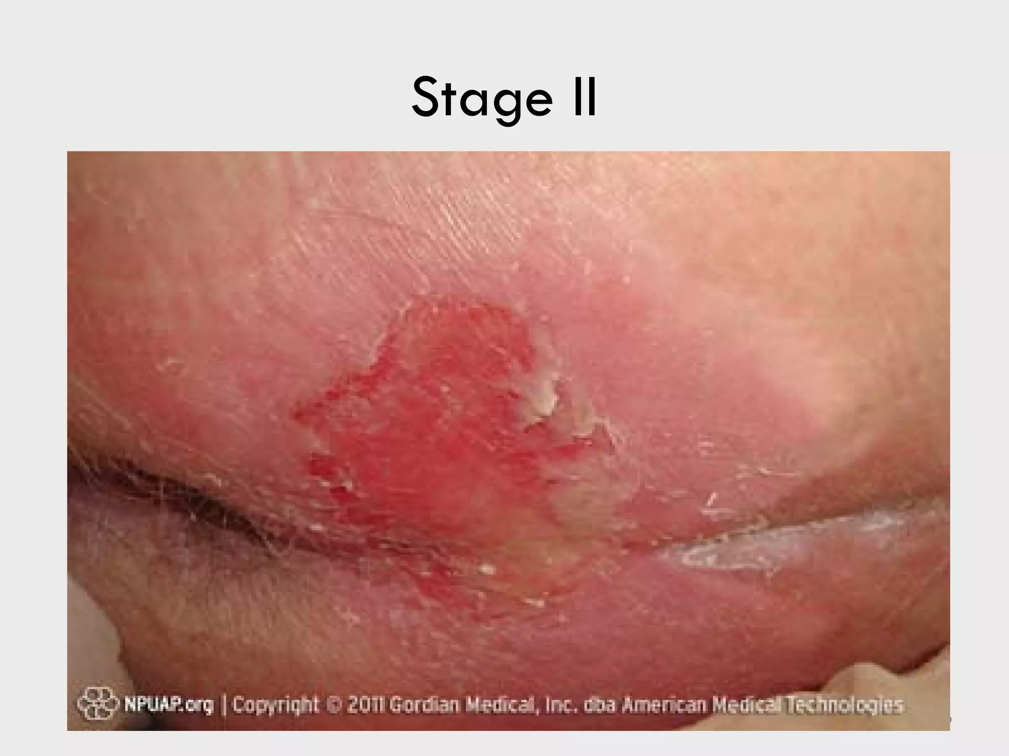 4 SKIN INTEGRITY AND WOUND CARE 2.pdf