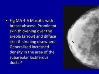 4 skin thickening | PPT