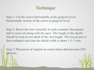 4) Socket shield technique prosthodontics | PPTX