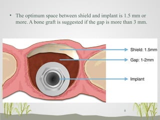 4) Socket shield technique prosthodontics | PPTX