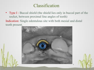 4) Socket shield technique prosthodontics | PPTX