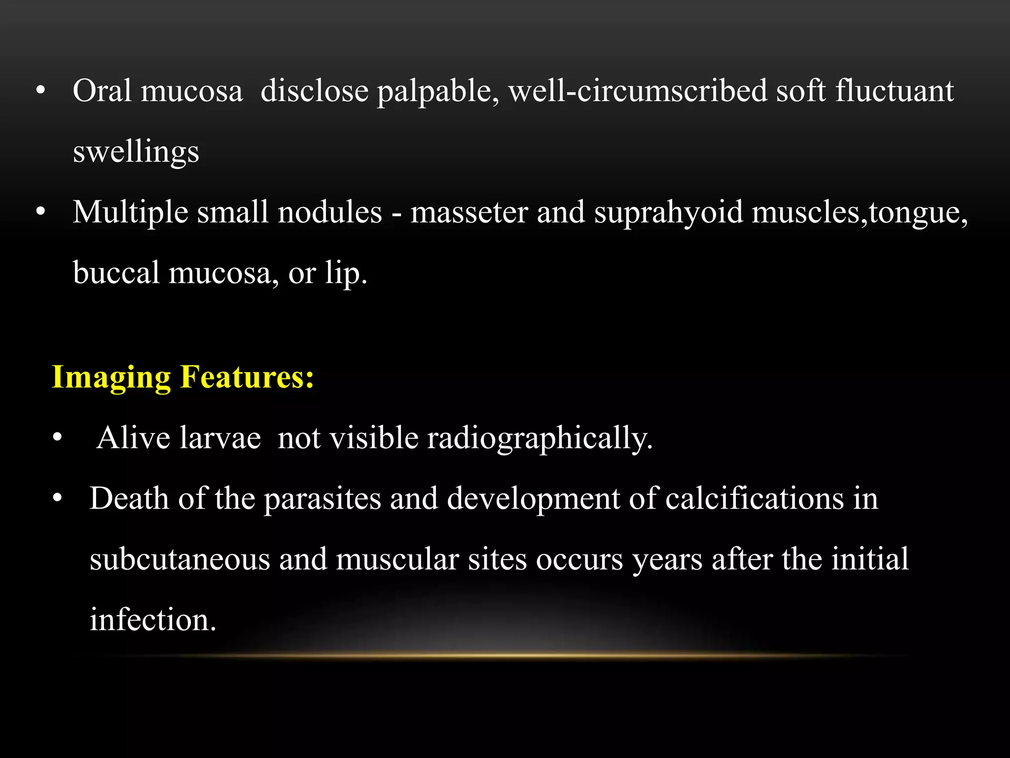Soft tissue calcifications of the oral cavity | PPTX