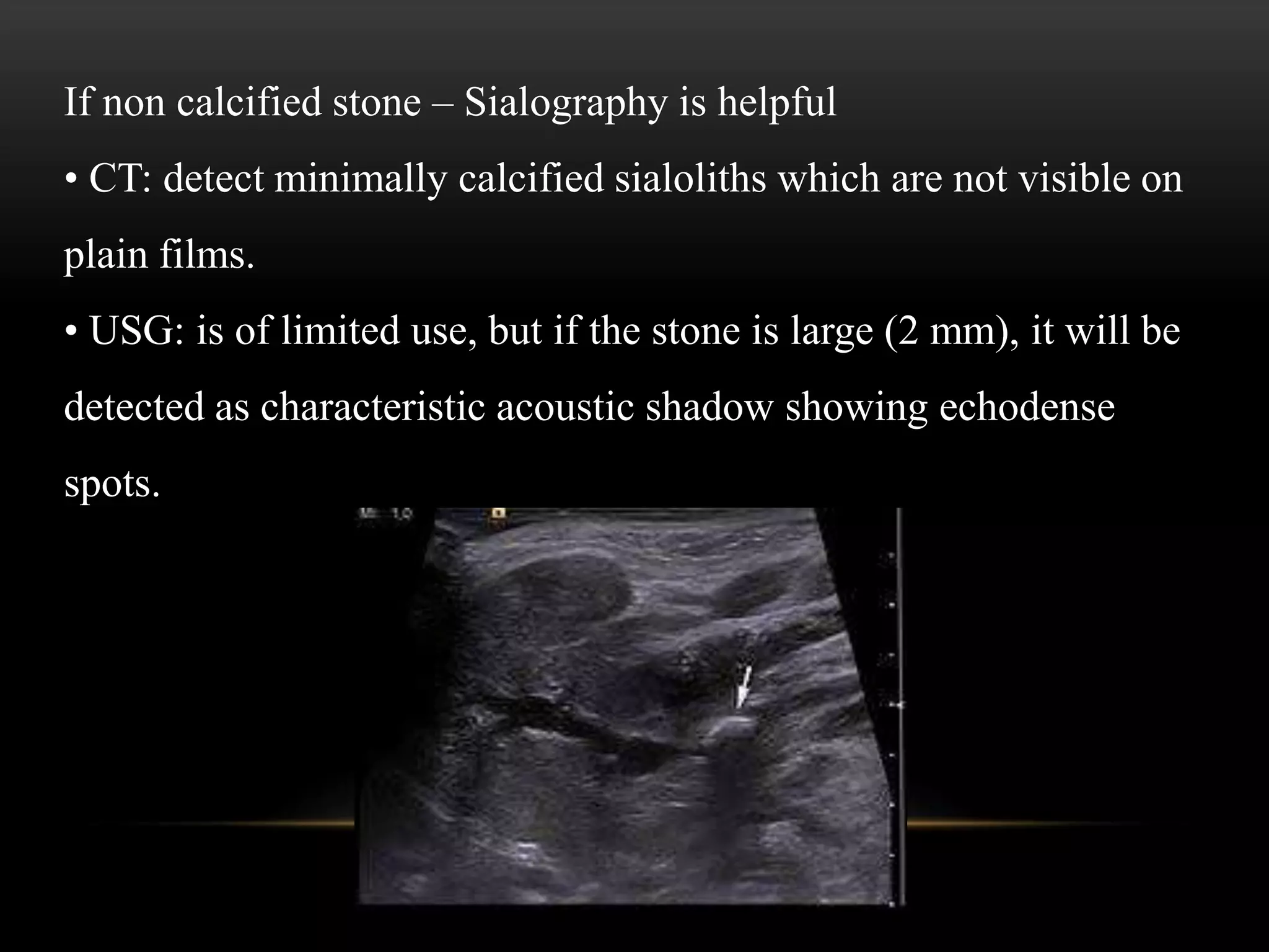 Soft tissue calcifications of the oral cavity | PPTX