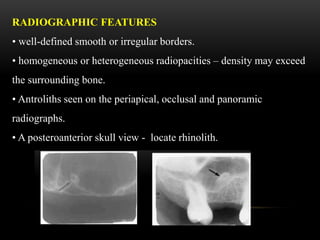 Soft tissue calcifications of the oral cavity | PPTX
