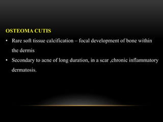 Soft tissue calcifications of the oral cavity | PPTX