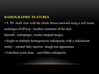 Soft tissue calcifications of the oral cavity | PPTX