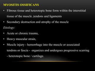 Soft tissue calcifications of the oral cavity | PPTX