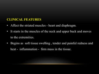 Soft tissue calcifications of the oral cavity | PPTX