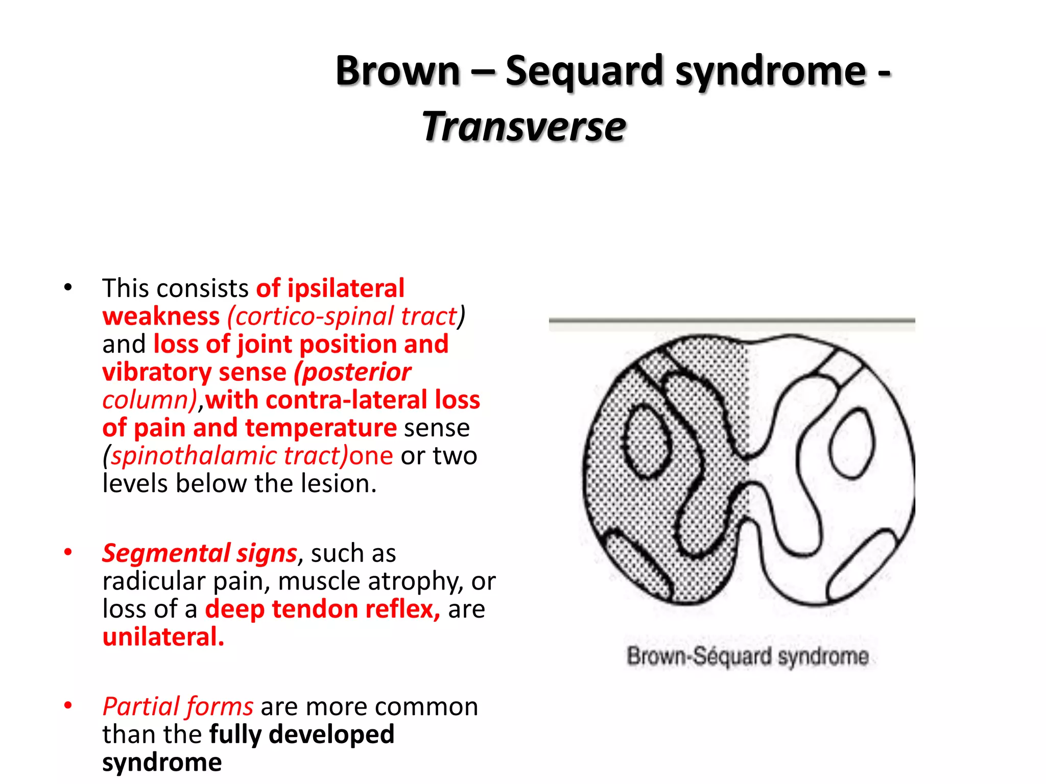 4 spinal cord ds.pptx