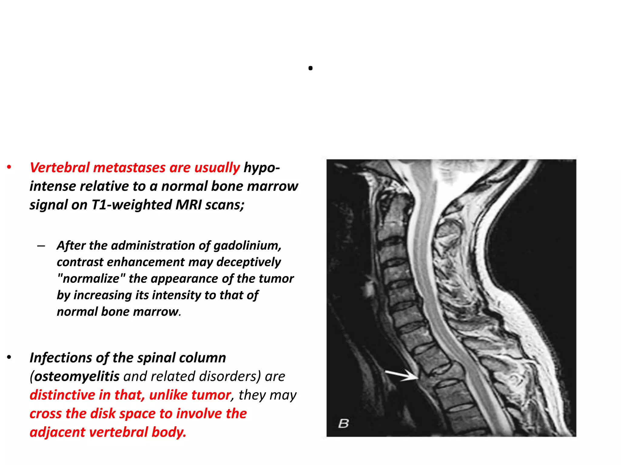 4 spinal cord ds.pptx