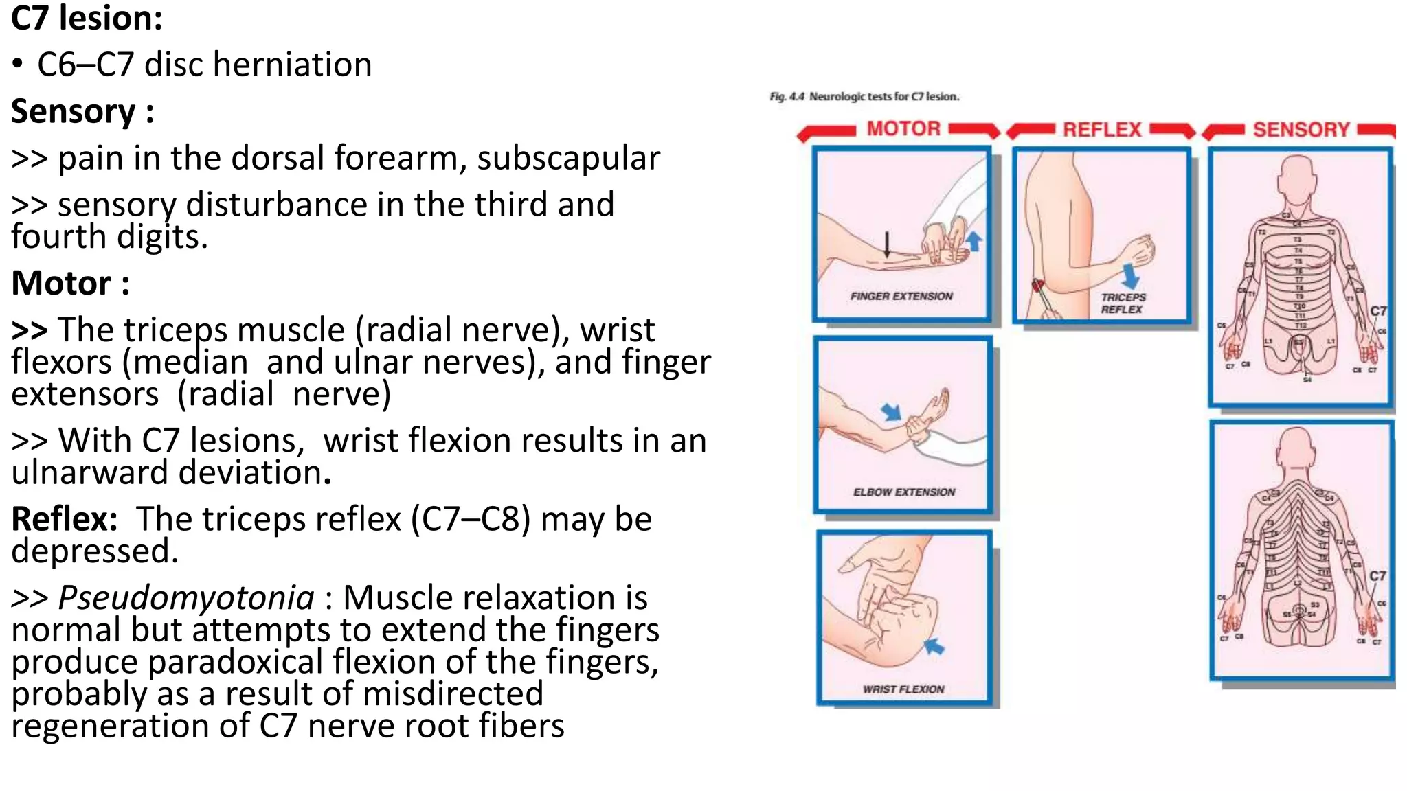 spinal nerves and roots | PPTX