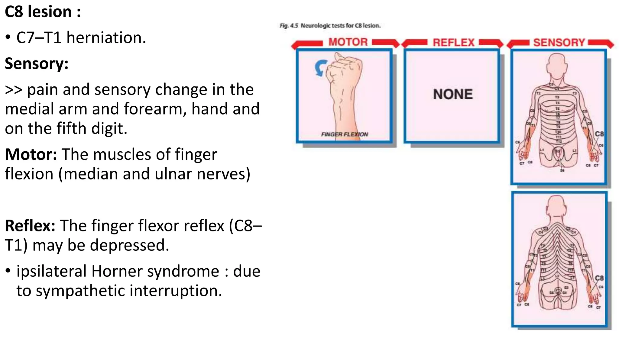 spinal nerves and roots | PPTX