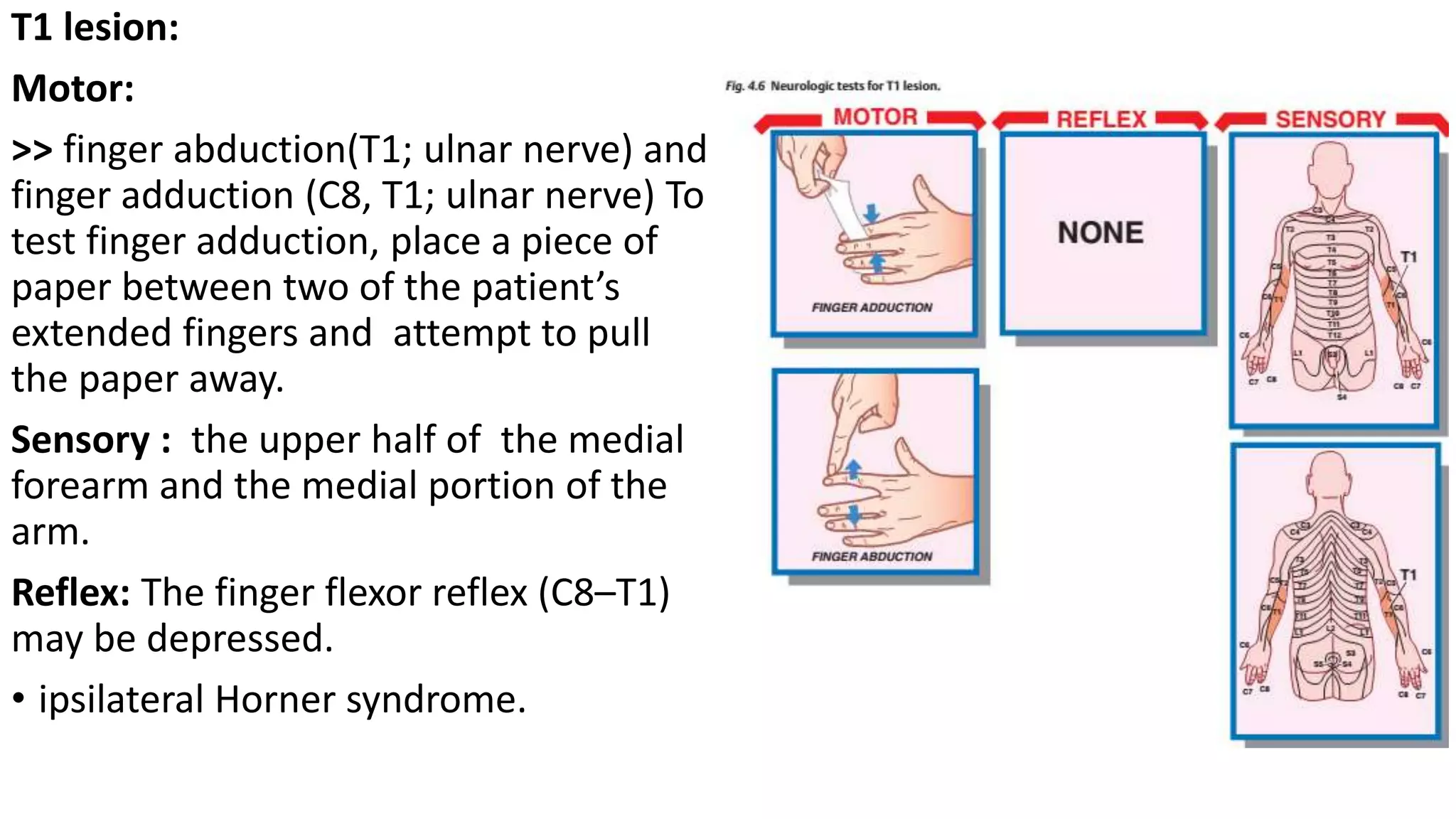 spinal nerves and roots | PPTX