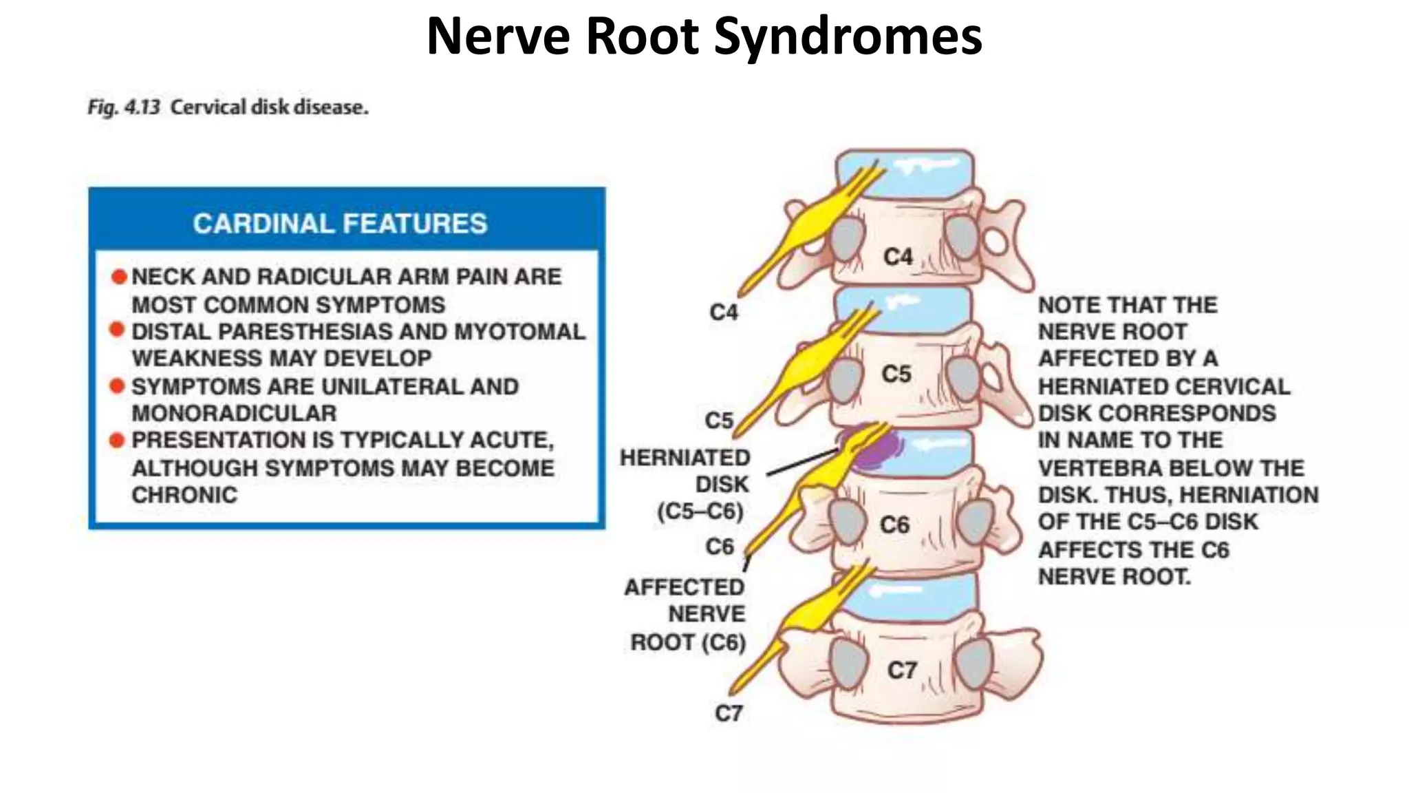 spinal nerves and roots | PPTX