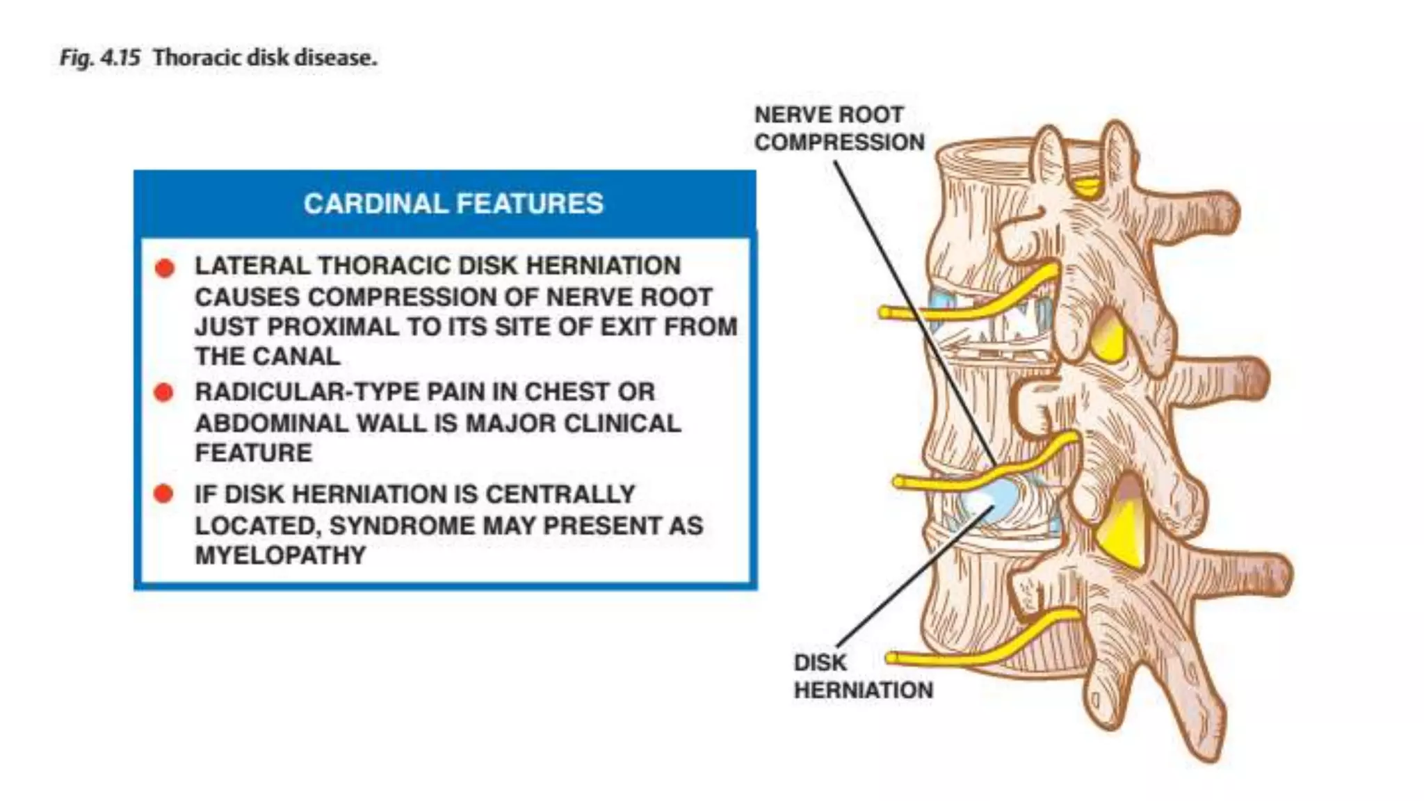 spinal nerves and roots | PPTX