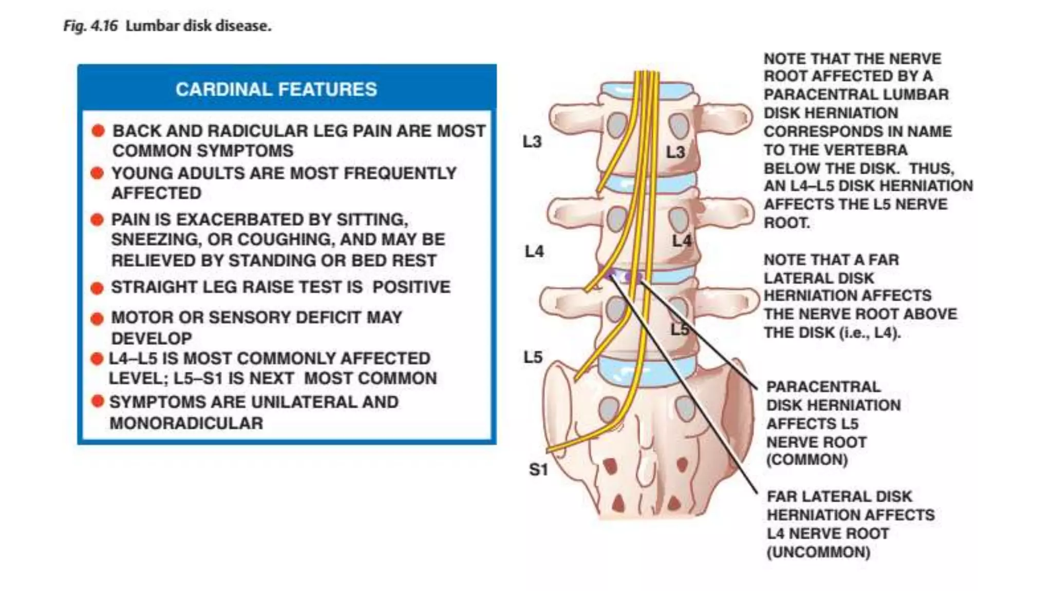 spinal nerves and roots | PPTX