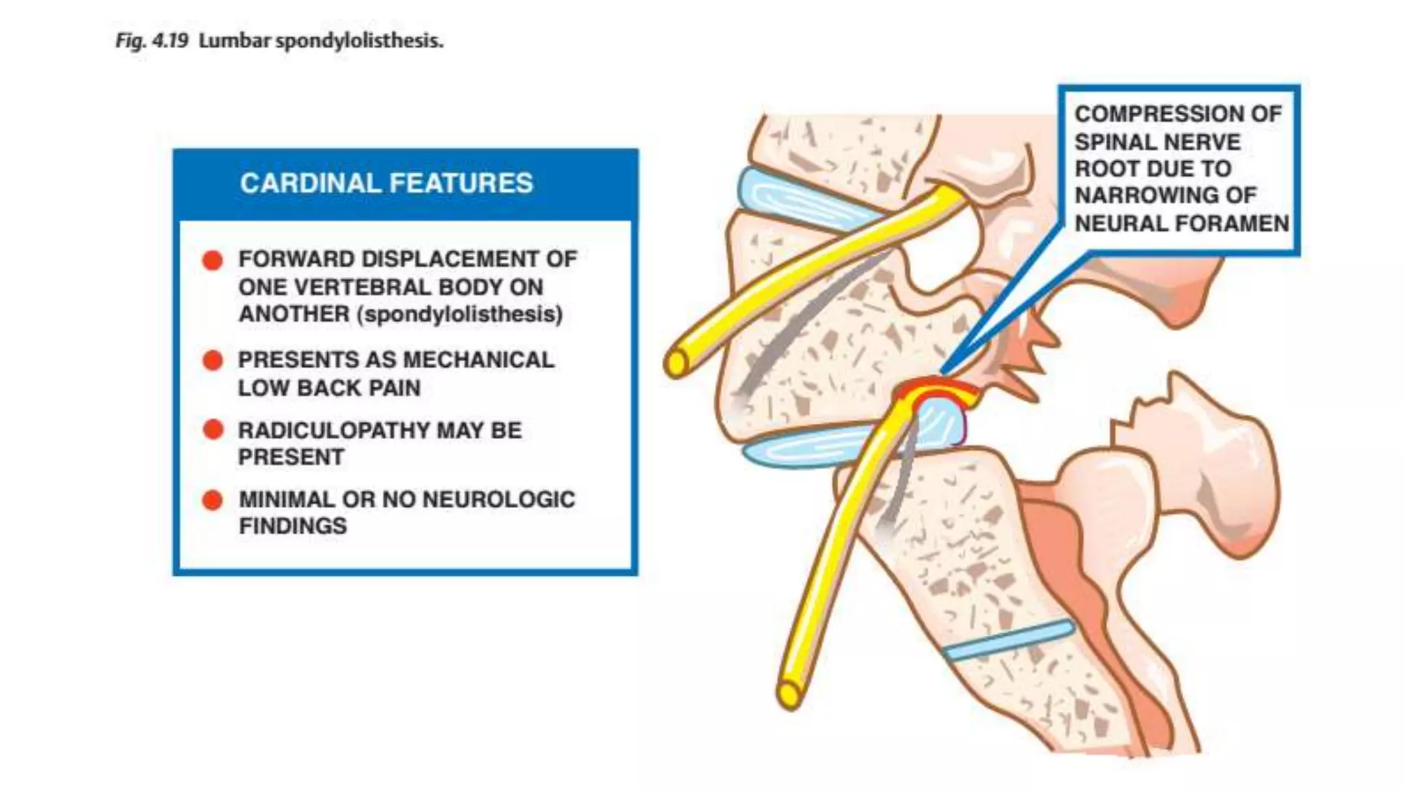 spinal nerves and roots | PPTX