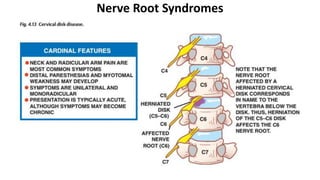 spinal nerves and roots | PPTX