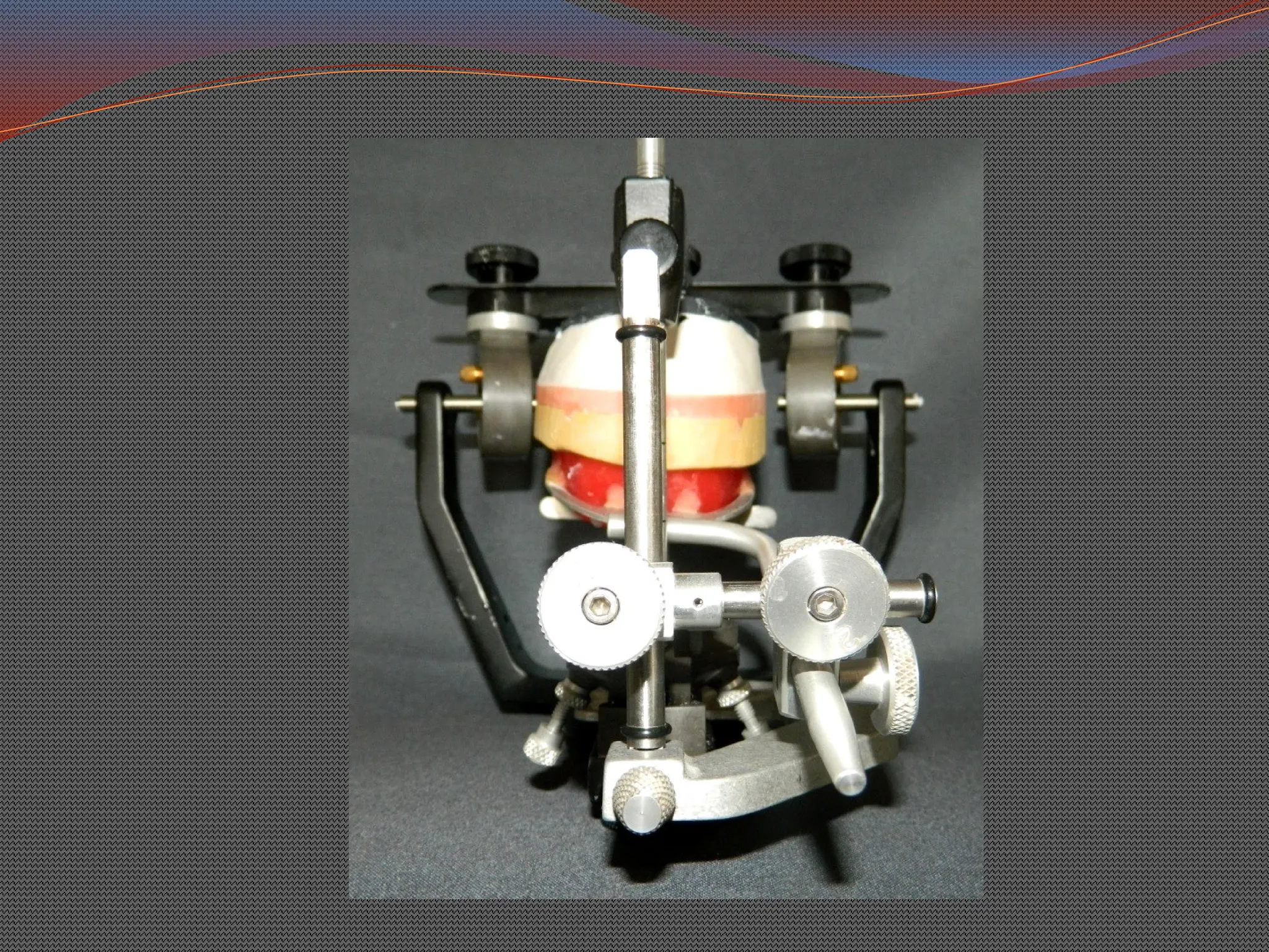 4 Split cast. complete denture lab work. | PPTX