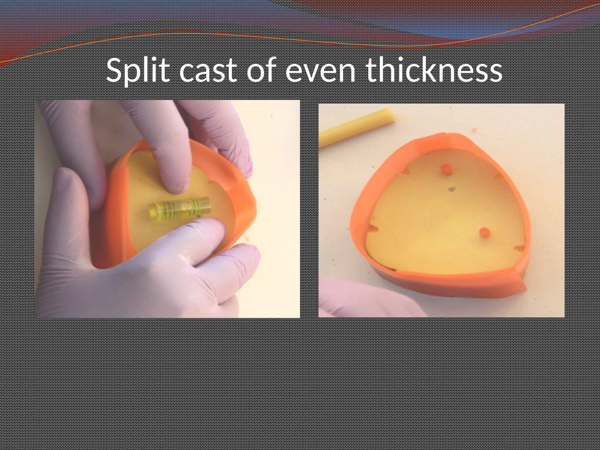 4 Split cast. complete denture lab work. | PPTX
