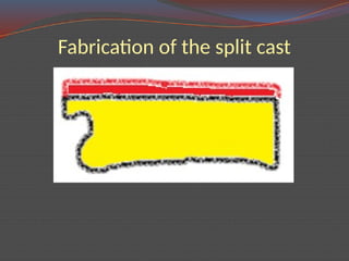 4 Split cast. complete denture lab work. | PPTX