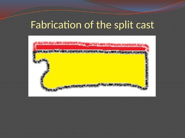 4 Split cast. complete denture lab work. | PPTX