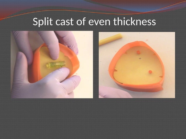 4 Split cast. complete denture lab work. | PPTX