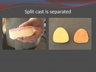 4 Split cast. complete denture lab work. | PPTX