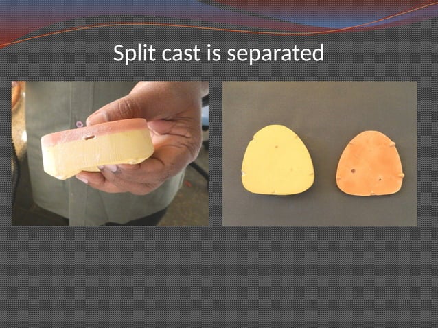 4 Split cast. complete denture lab work. | PPTX