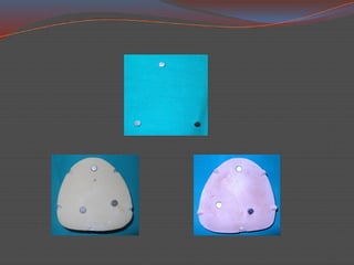 4 Split cast. complete denture lab work. | PPTX