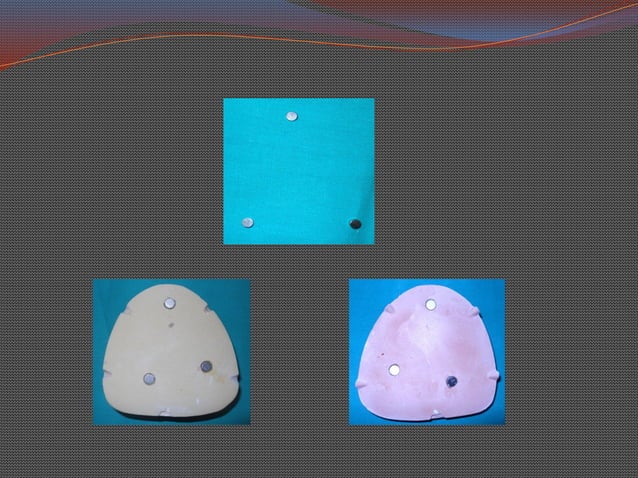 4 Split cast. complete denture lab work. | PPTX